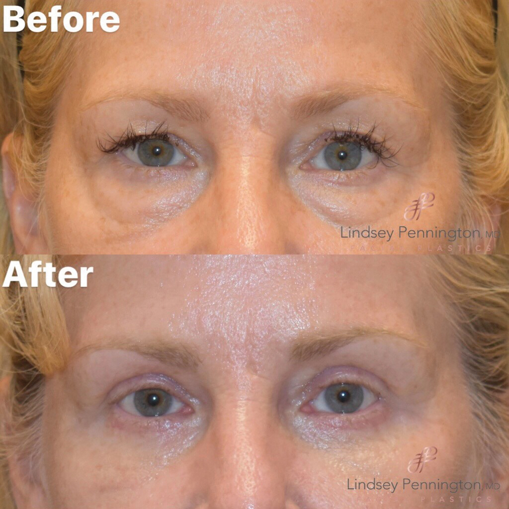 Tips & Tricks to Combat Common Signs of Aging | Lola Magazine